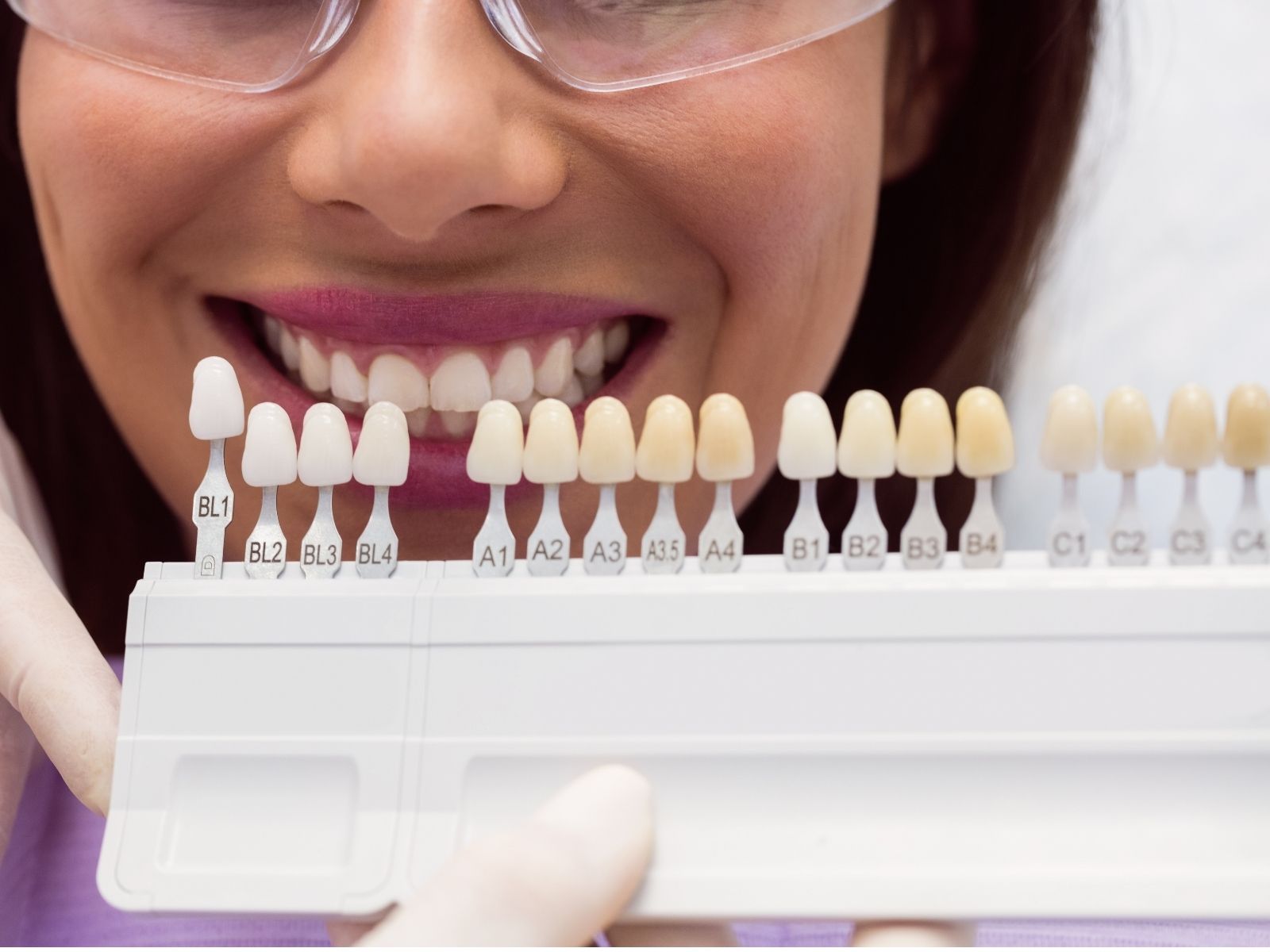 Porcelain Dental Bridge | Sinton Dentist TX